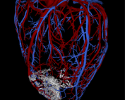 Research Themes | UW Bioengineering