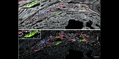 UW researchers show engrafted heart cells divide and replicate | UW ...