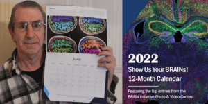 Eric H. Chudler | UW Bioengineering