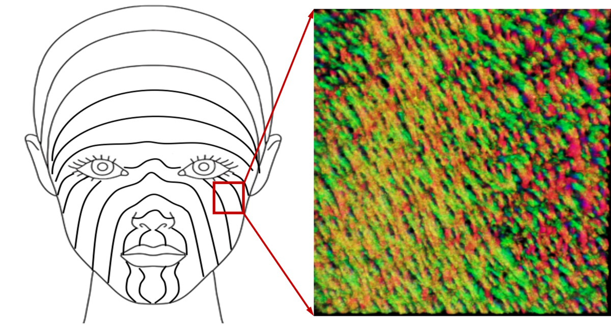 Imaging method captures deep layers of collagen in 3D | UW Bioengineering