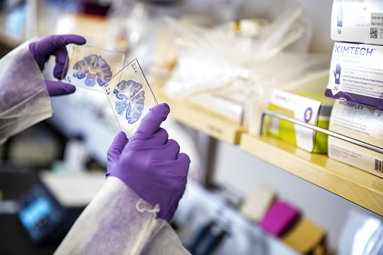 UW-led team receives $4.2M grant to develop AI-guided brain stimulation ...