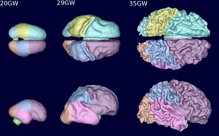 New technology images fetal brain activity in 4D | UW Bioengineering