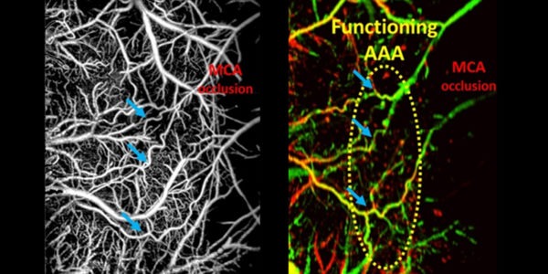 Optical coherence tomography based microangiography provides an ability ...